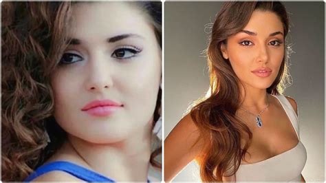 Photo Before Plastic Surgery The Woman Of The Year Did 10 Operations