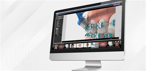 ORTHO2 BLOG Edge Animations And Treatment Findings