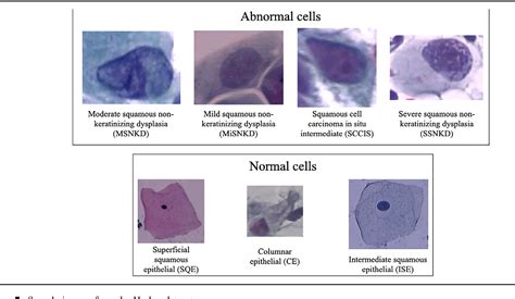 Figure From Nucleus Segmentation And Classification Using Residual Se