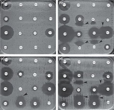 Extended Spectrum β Lactamase Detection By A Double Disk Diffusion Test Download Scientific