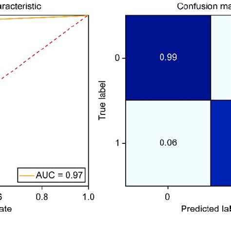 Pectus Excavatum Is Diagnosed By Haller Index 3 25 Calculation Of Download Scientific Diagram