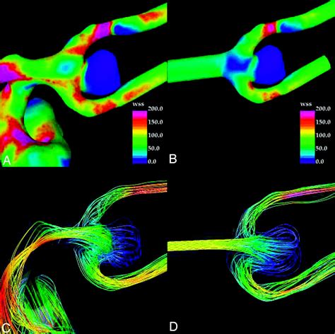 Computational Fluid Dynamics Modeling Of Intracranial Aneurysms