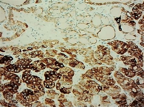 Thy3a Pvptc Niftp Rcpath Document