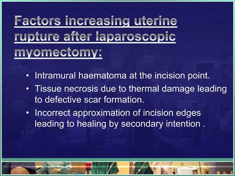 Myomectomy Laparoscopic Vs Laparotomy 2 Ppt