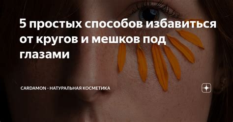 5 простых способов избавиться от кругов и мешков под глазами | Cardamon ...