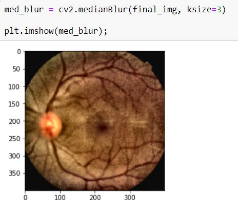 Github Ierolsen Diabetic Retinopathy Detection This Repo Contains A Bunch Of Models That