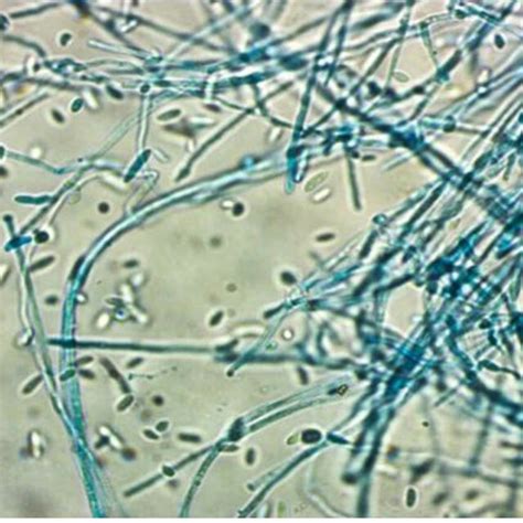 Fusarium Species In Lpcb Mount Download Scientific Diagram