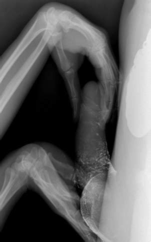 X Ray Sex XNXX Adult Forum