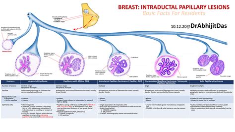Dr Abhijitdas Intraductal Papillary Lesions Breast Basic Facts For