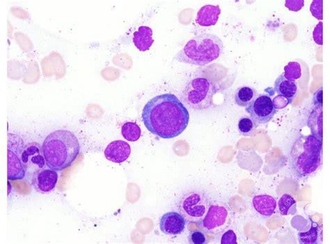 Proerythroblast Vs Basophilic Erythroblast