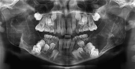 11 Dental Anomalies Pocket Dentistry