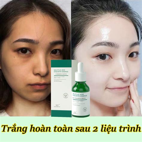 Serum Trắng Da Serum Se Khít Lỗ Chân Lông 30ml Se Khít Lỗ Chân Lông Lột