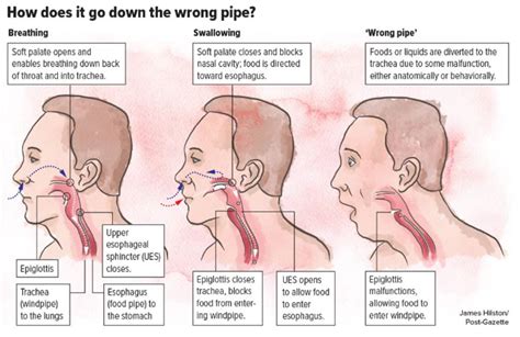Post Gazette Coughing Up The Details Of What Down The Wrong Pipe