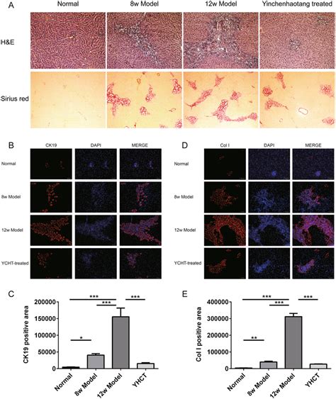 Histological Features Of Anit Induced Cholestasis Model A Hande And