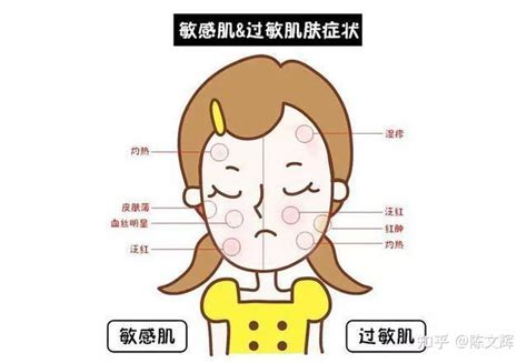春季皮肤过敏发红发痒怎么办？ 知乎