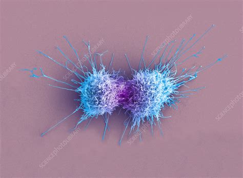 Cervical Cancer Cells Dividing Sem Stock Image C056 8079 Science Photo Library