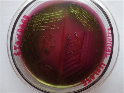 Biochemical Tests Biochemcal Tests Imvic Showed For The Bacteria