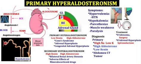 Hyperaldosteronism Hypernatremia