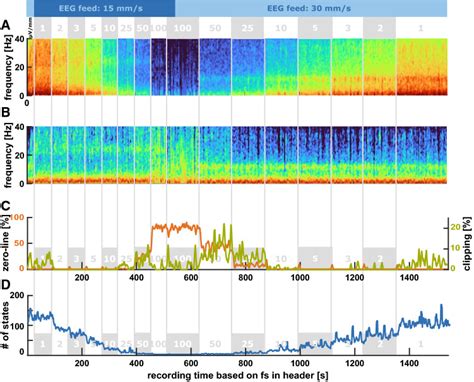 Technical Considerations When Using The Eeg Export Of The Sedline Root Device Pmc