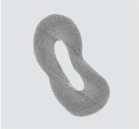 B An Adjacent Section Of The Same Tooth As Shown In A But Now After