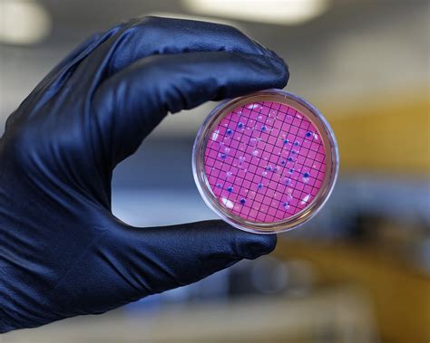 Its A Small World Three Microbiology Images Coliforms An… Flickr