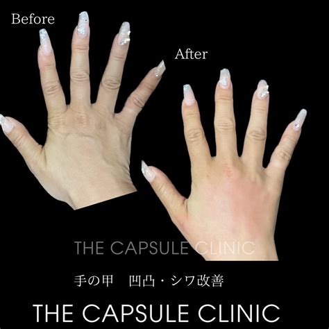 プレミアムprp The Capsule Clinic