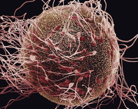 Here Is An Sem Image Of An Egg Being Surrounded By Sperm Cells