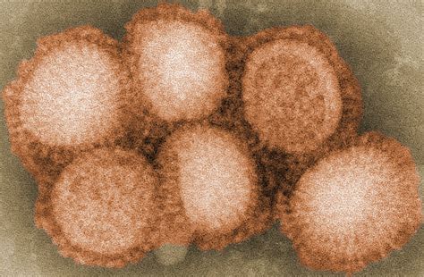 Health News Roundup Bird Flu Reaches Mainland Antarctica For First