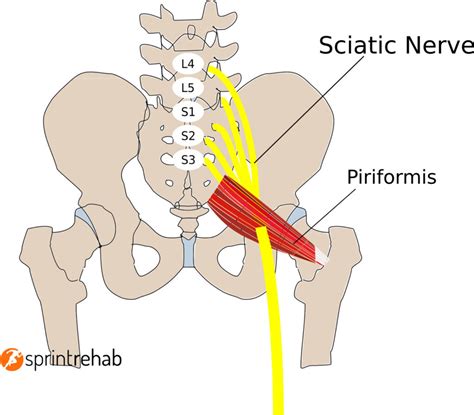 Piriformis Strain