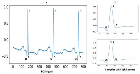 Sensors Free Full Text Hybrid Deep Learning And Discrete Wavelet Transform Based Ecg