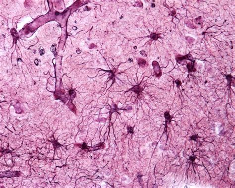Astrocytes Light Micrograph Stock Image C048 3027 Science Photo