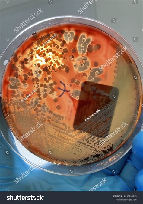 Staphylococcus Aureus Streptococcus Agalactiae Columbia Agar Stock
