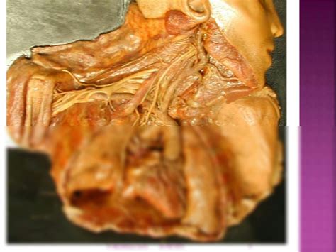 Solution Anatomie1an Nerf Radial Ulnaire Autres2021belhoula Studypool