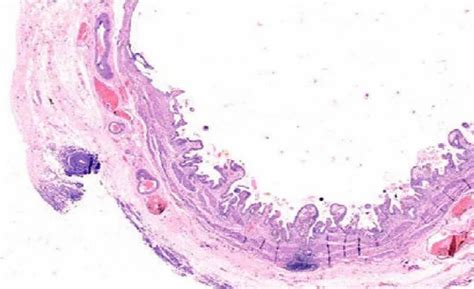 Gall Bladder Slide Labeled