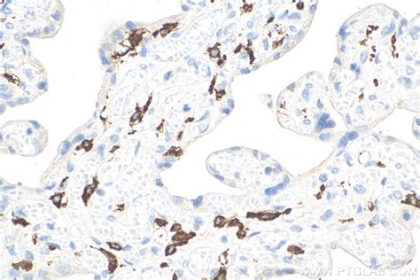 Cd206 Antibody 81525 1 Rr Proteintech