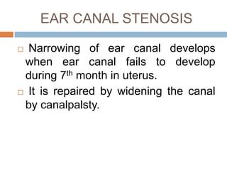 Congenital Ear Deformities Pptx