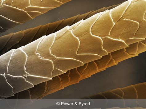 Animals Ps Micrographs Animals Ps Micrographs