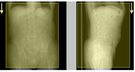 Rad 3051 Abdo Pelvis Ct Flashcards Quizlet