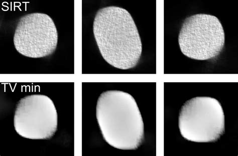 3 Comparison Of Sirt And Tv Minimization Reconstruction For The Download Scientific Diagram