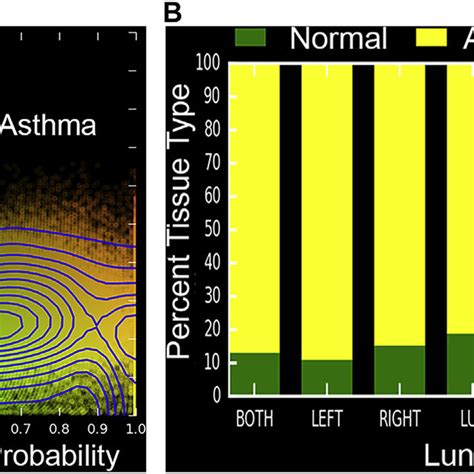 Mdct Chest Image Matching Parametric Response Mapping 22 And Disease Download Scientific