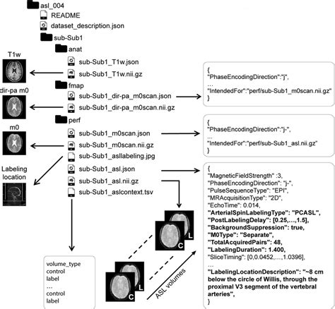 illustrates the ASL BIDS example dataset asl 004²⁹ which is a Download Scientific Diagram