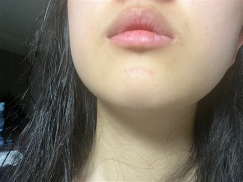 턱 아래 일자 자국 지식in