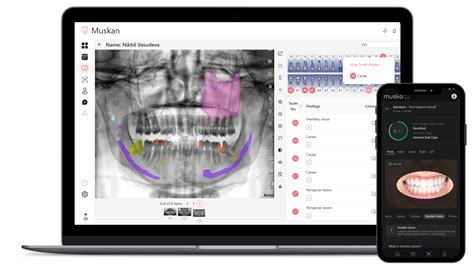 Muskanai Ai Powered Dentistry Home Page