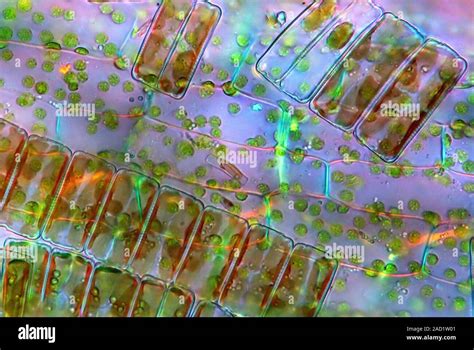 Diatoma Diatoms Polarised Light Micrograph Of Diatoma Sp Diatoms Rectangular Diatoms Are