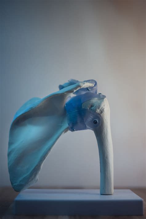 Understanding Shoulder Injections