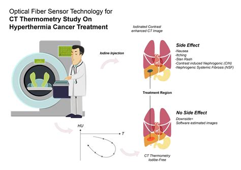 Non Invasive CT Thermometry In Hyperthermia Cancer Treatment Iestory