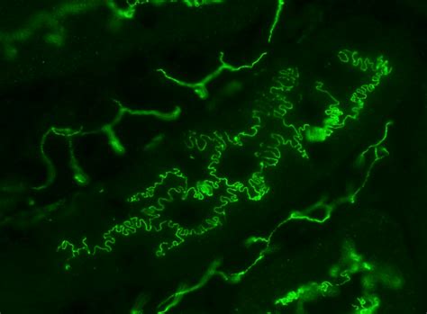 The Mathematics Of Cell Boundary ‘ruggedness News Digest Of