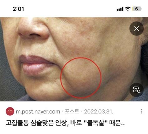 [잡담] 인성 끝판왕은 불독살있는 애들임 인스티즈 Instiz 일상 카테고리