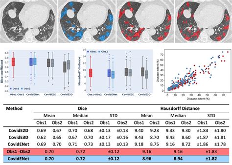 comparison between automated and manual segmentations delineation of