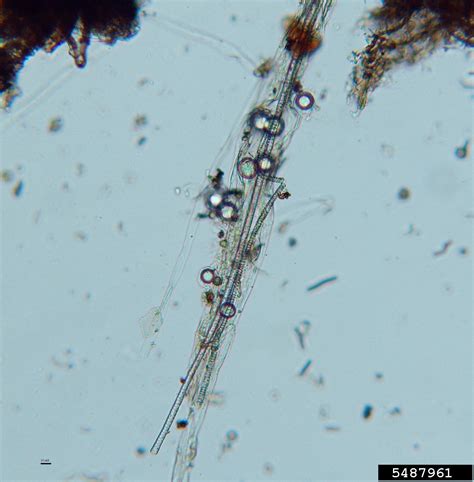 Pythium Diseases Genus Pythium
